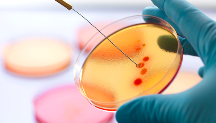 Microbiology Analysis | IDEXX BioAnalytics